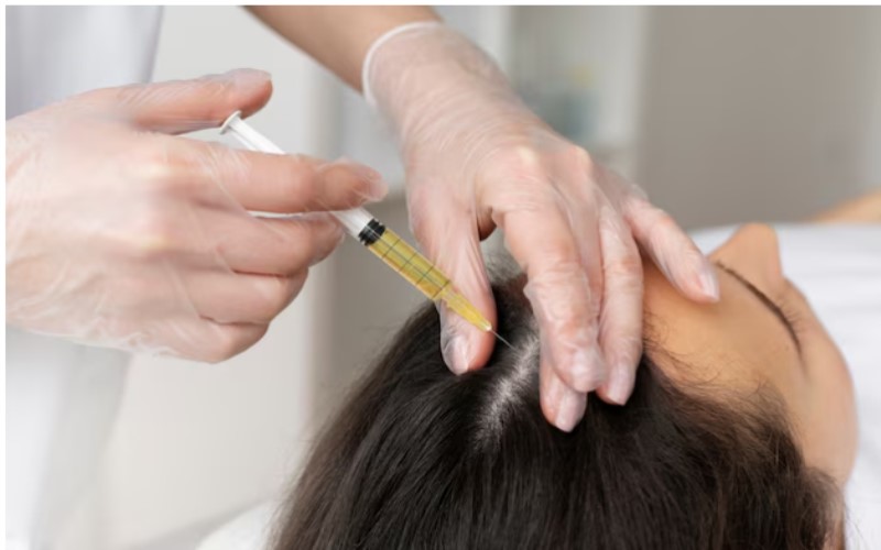 The Benefits of Plasma Therapy for Hair Restoration